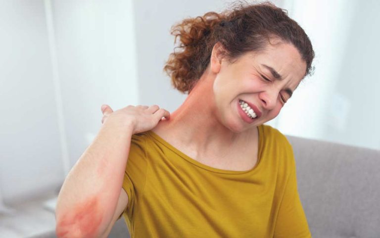 7 Signs of Anaphylaxis | Healthy Research